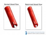 Does Nicotine Cause Vasoconstriction Or Vasodilation?
